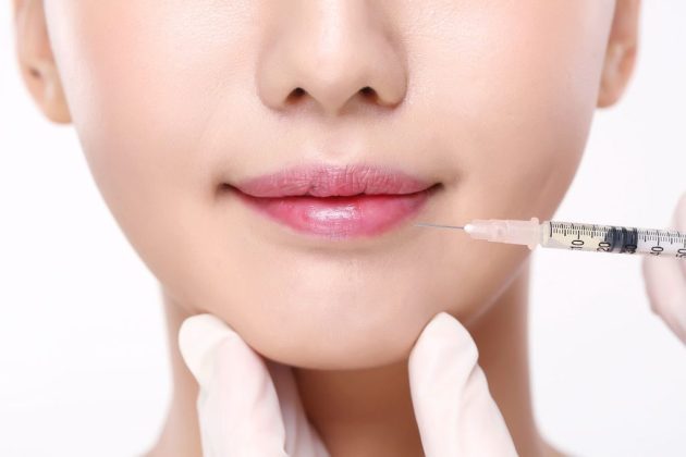 Mouth Corners Lift: The Difference Between Fillers and Botox